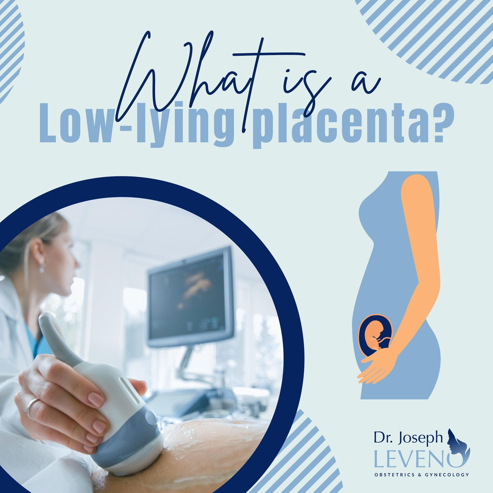 What Is A Low Lying Placenta Dr Joseph Leveno