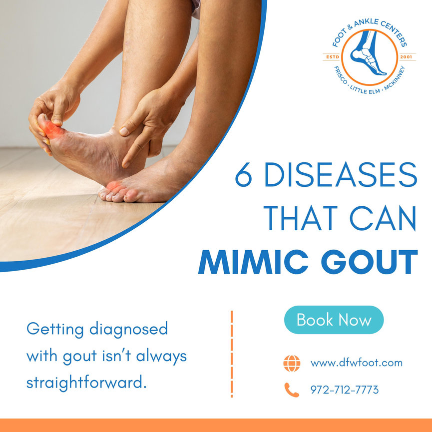 6 Diseases That Can Mimic Gout - Foot & Ankle Centers of Frisco and Plano
