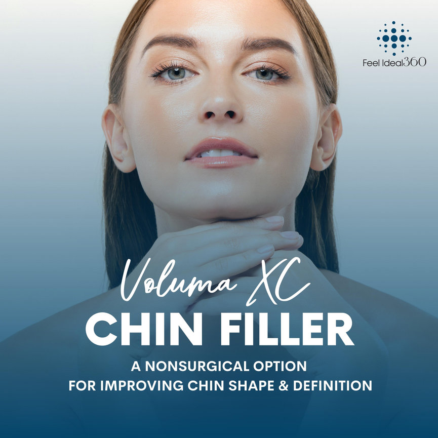 Nonsurgical Option For Chin Improvements! - Feel Ideal 360 Med Spa ...